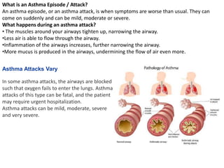 Asthma | PPTX