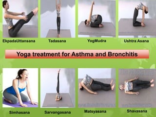 Asthma | PPT