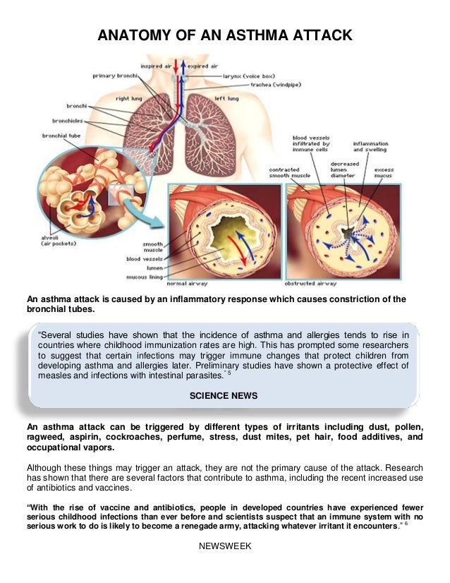 Anatomy Of An Asthma Attack