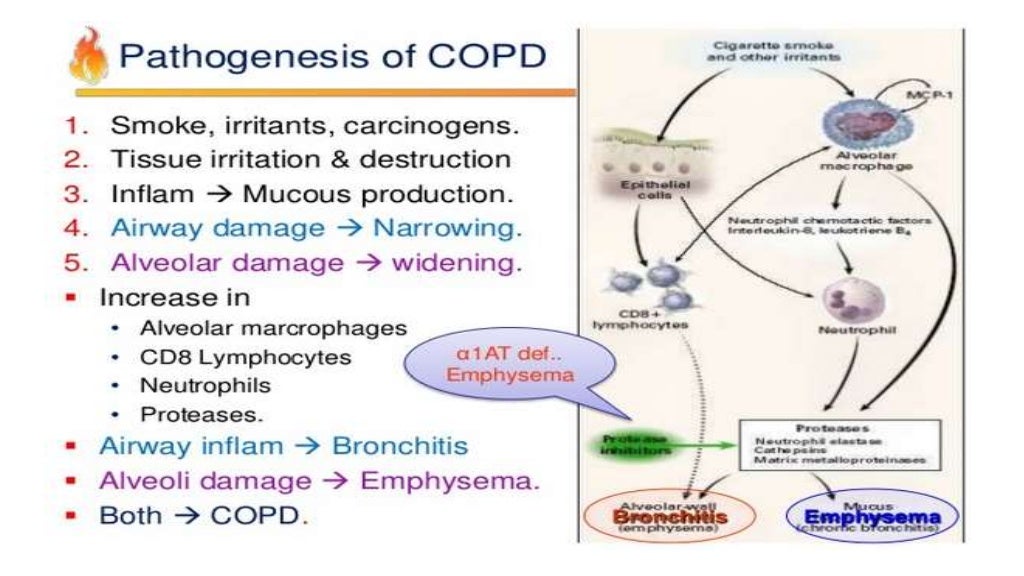 pathophysiology of asthma and COPD