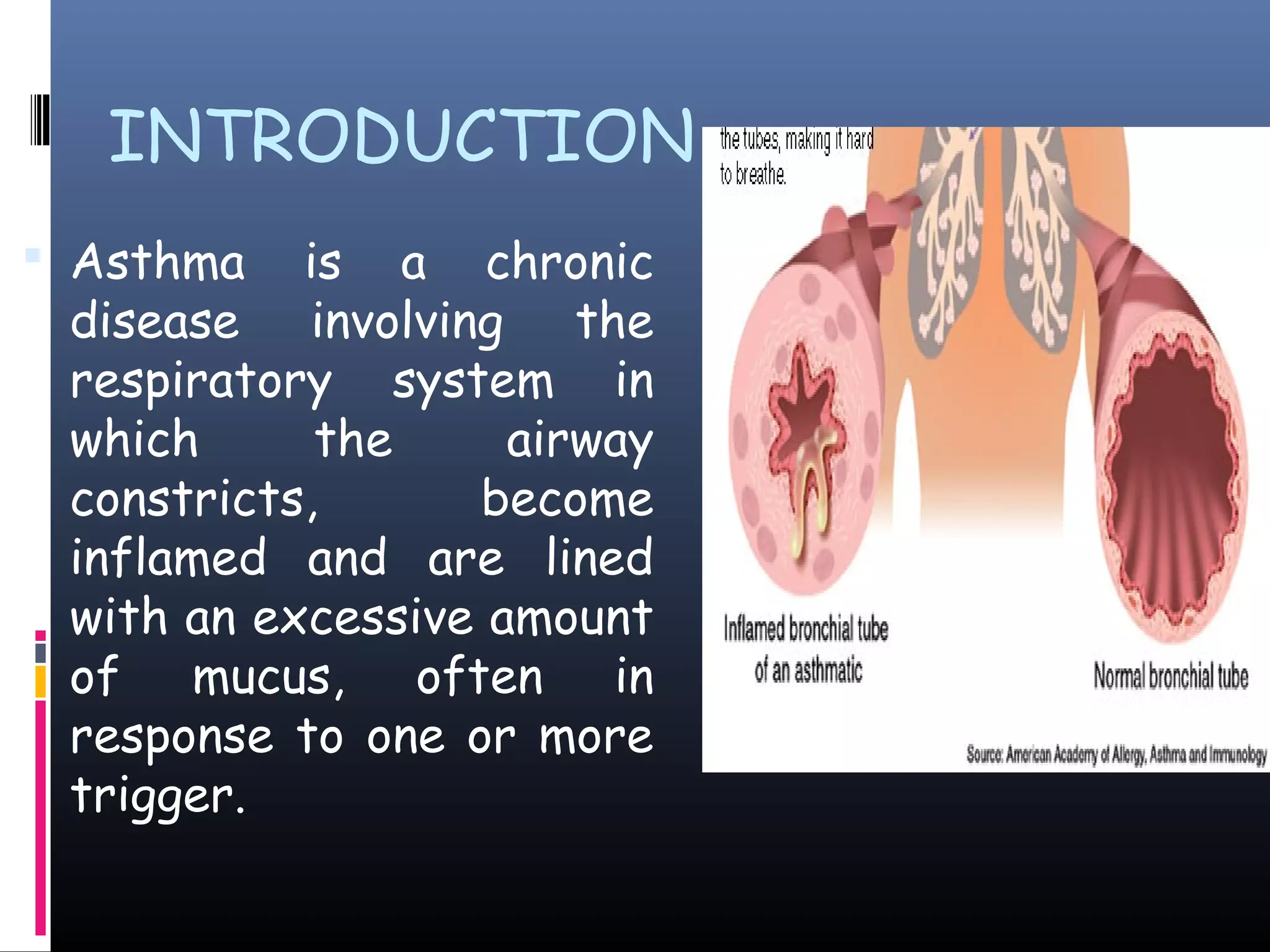Asthma | PPT