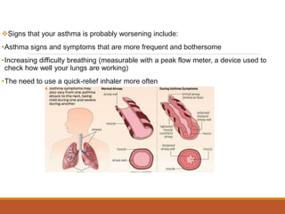 Asthma | PPTX