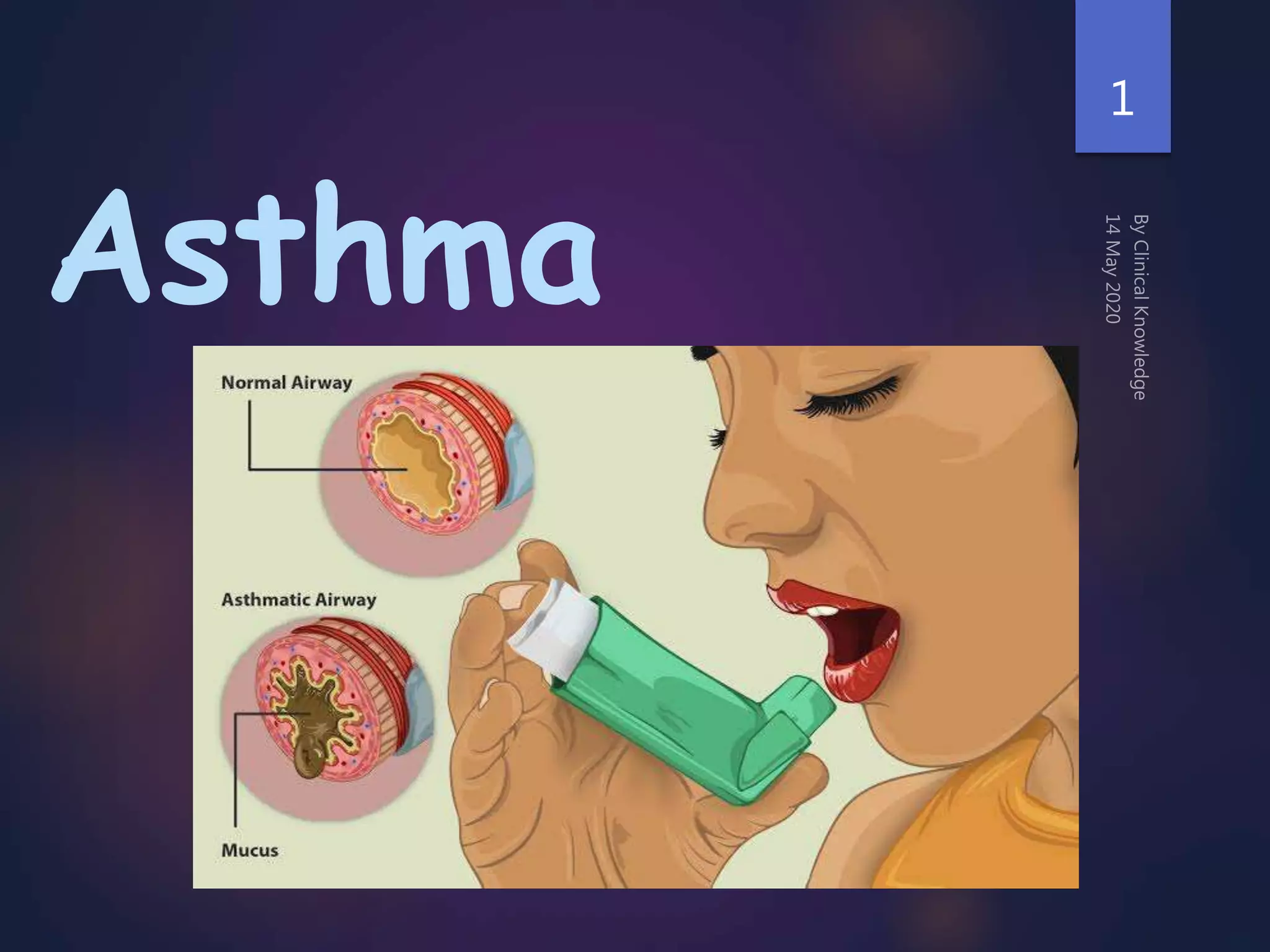 Asthma | PPTX | Lung and Respiratory Health | Diseases and Conditions