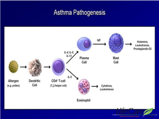 Update on ASTHMA (2020) By Dr Rahul Jain & Dr Sharda Jain | PPTX