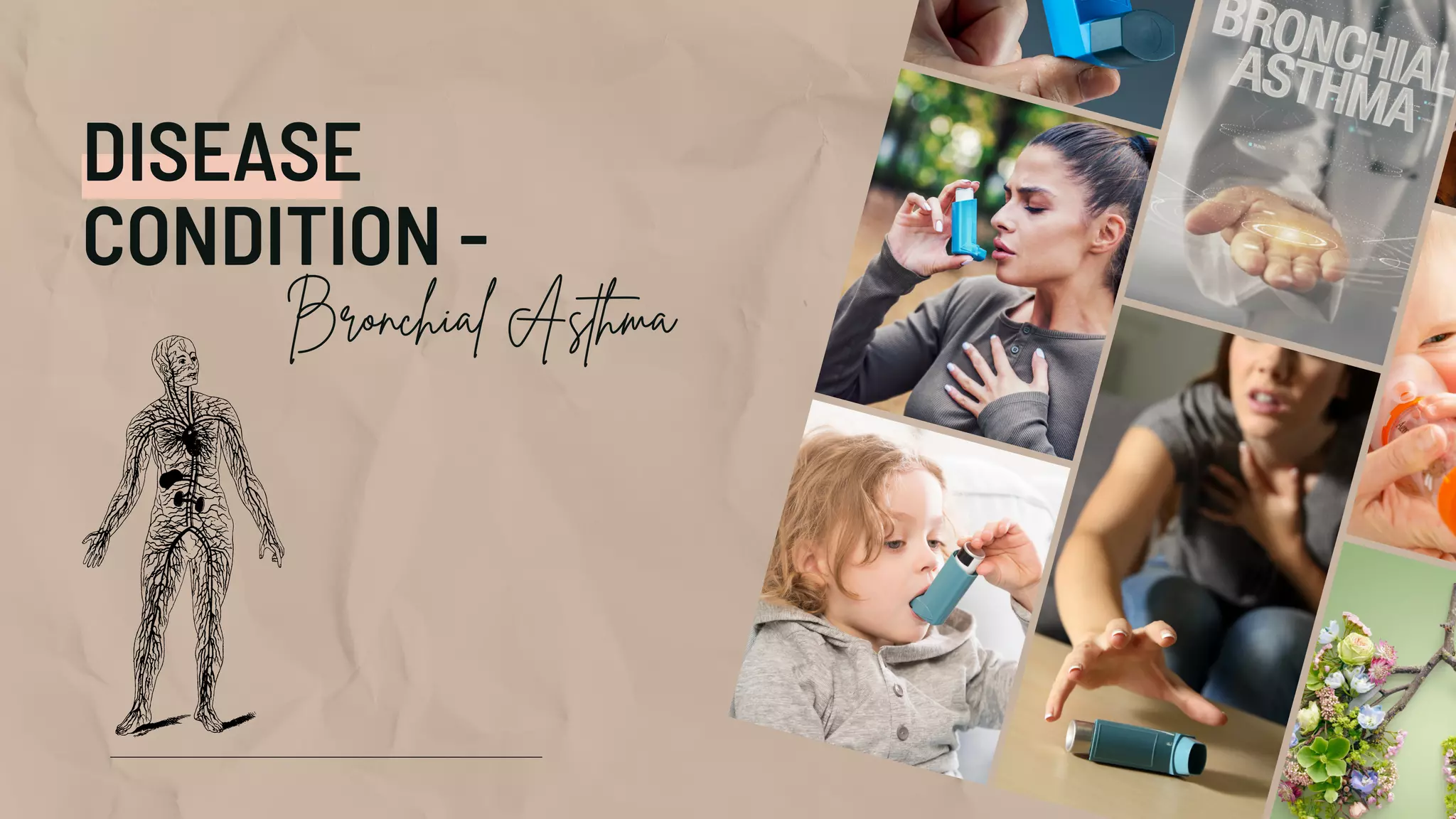 Case presentation on bronchial asthma | PDF