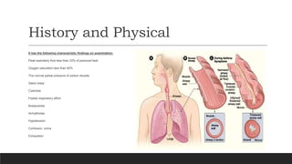 ASTHMA and it's Physiotherapy Treatment.pptx