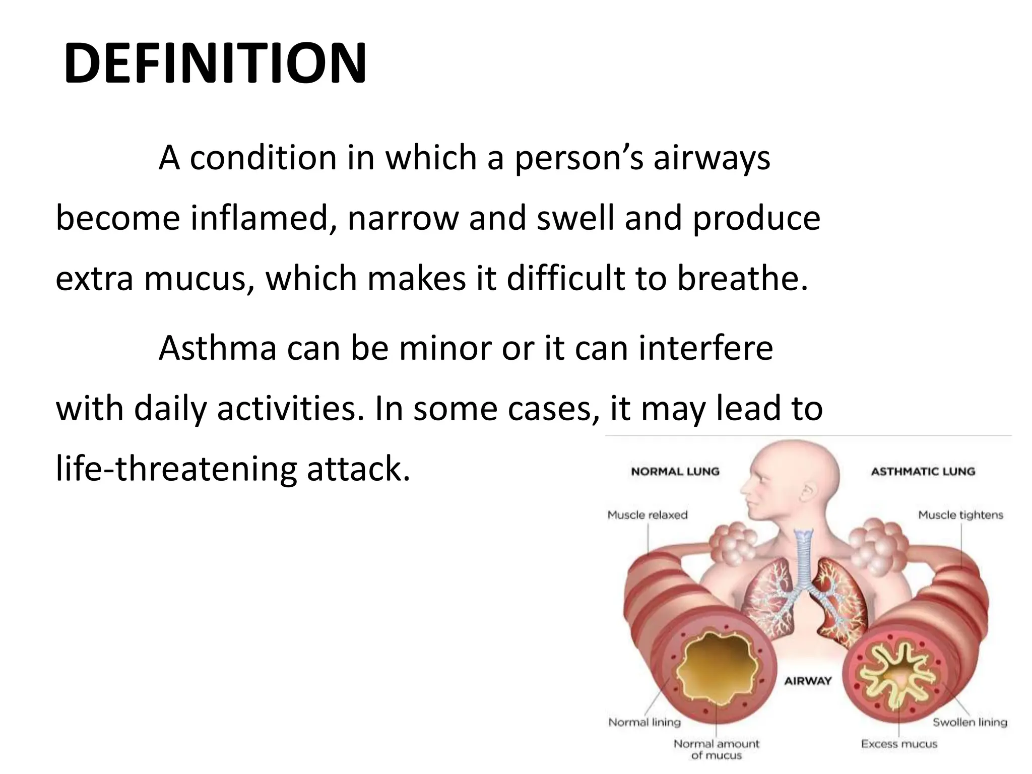 ASTHMA etiology, risk factors, pathophysiology and it's management | PPTX