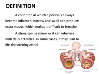 ASTHMA etiology, risk factors, pathophysiology and it's management | PPTX
