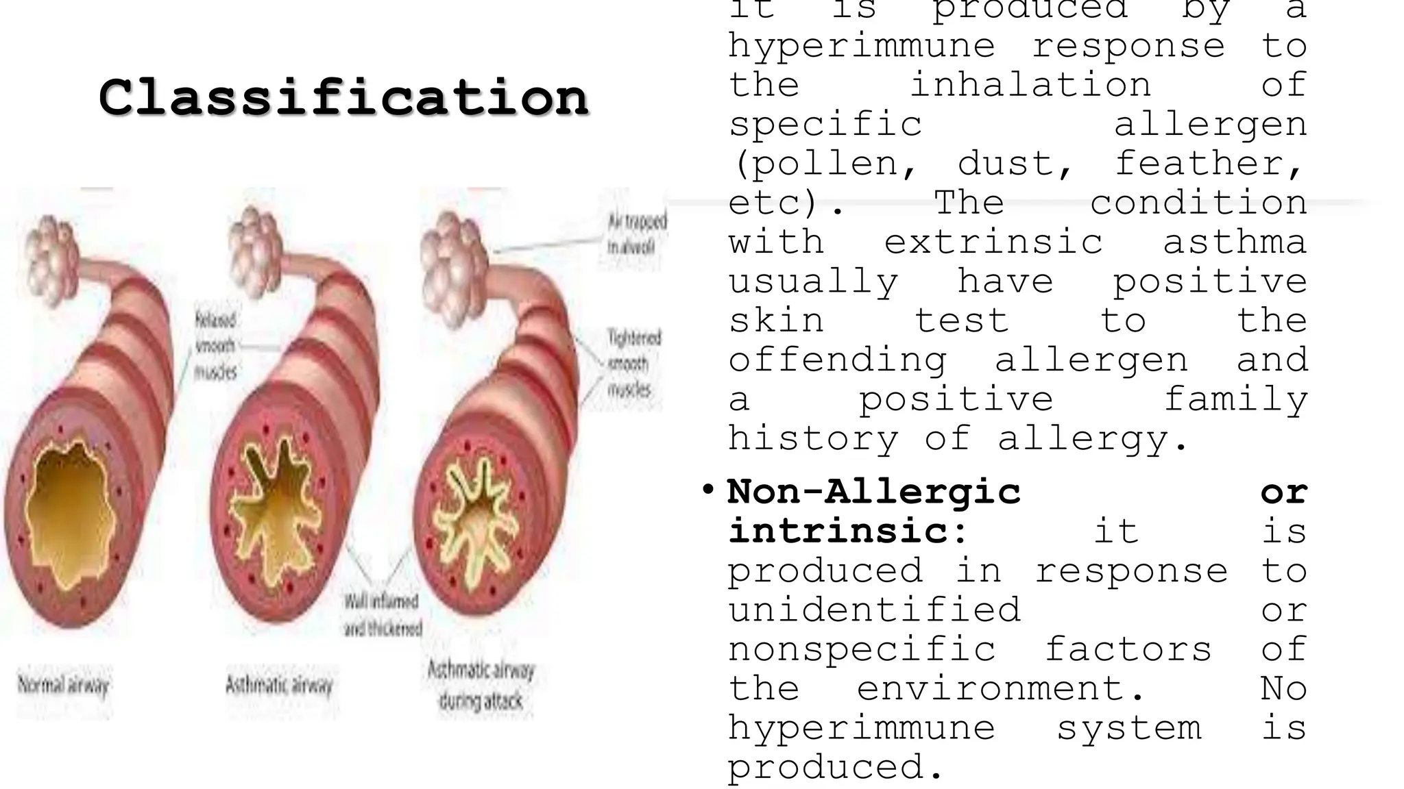 asthma.pptx, Child Health nursing, Respiratory system | PPTX