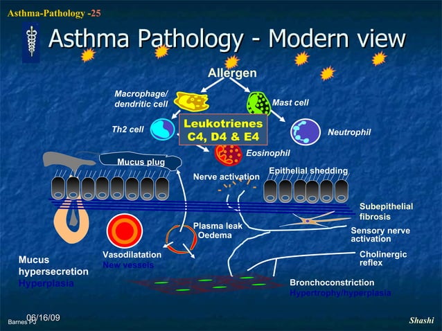 Asthma Pathophysiologyn 1233730055155655 1 | PPT