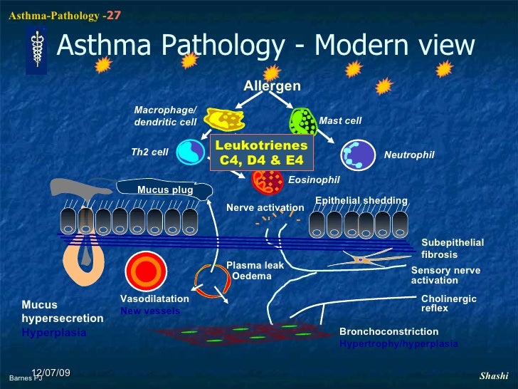 Asthma Pathophysiology N