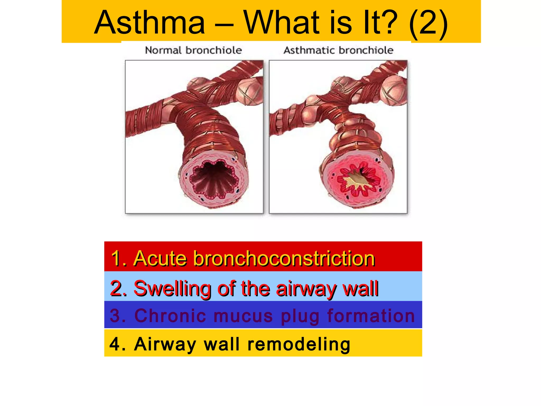 Asthma prevention Community medicine | PPT