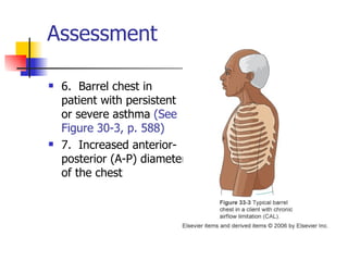 Asthma And Smoking | PPT