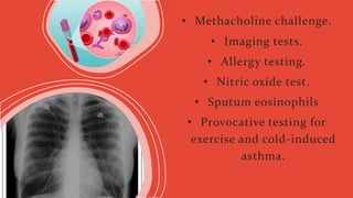Asthma chn | PPTX