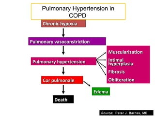 Asthma copd | PPT