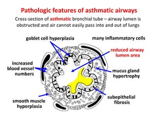 Asthma introduction Quiz Content slides 1 - 8 | PPTX