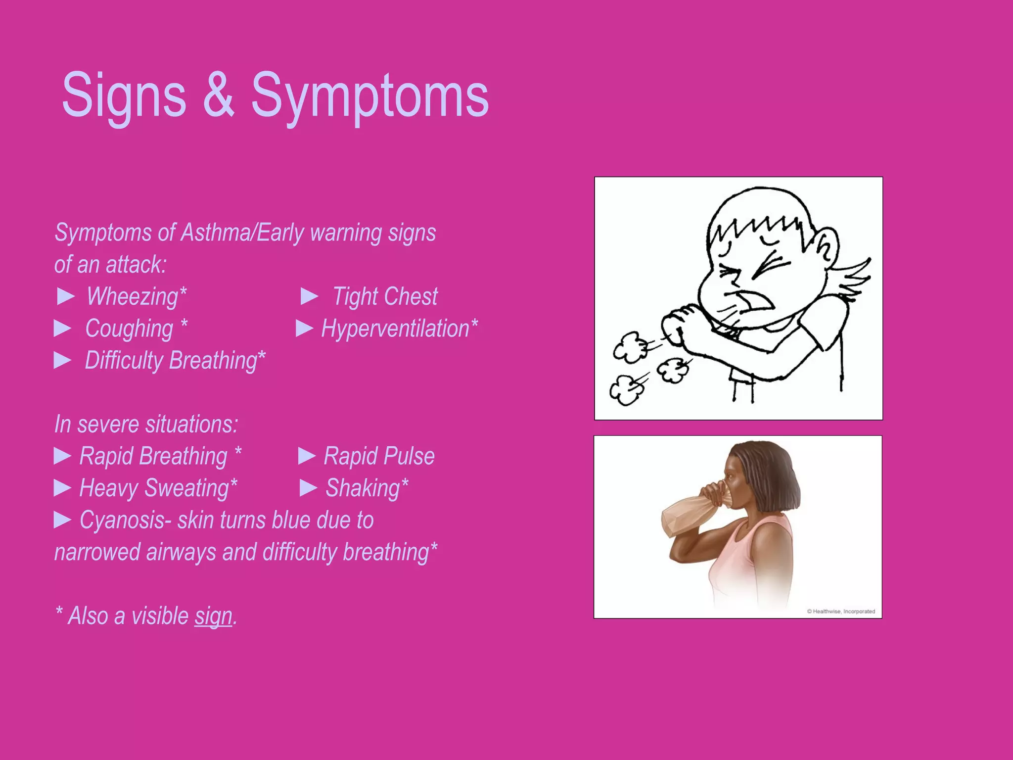Asthma | PPT
