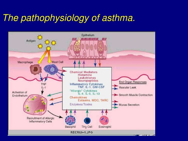 Asthma