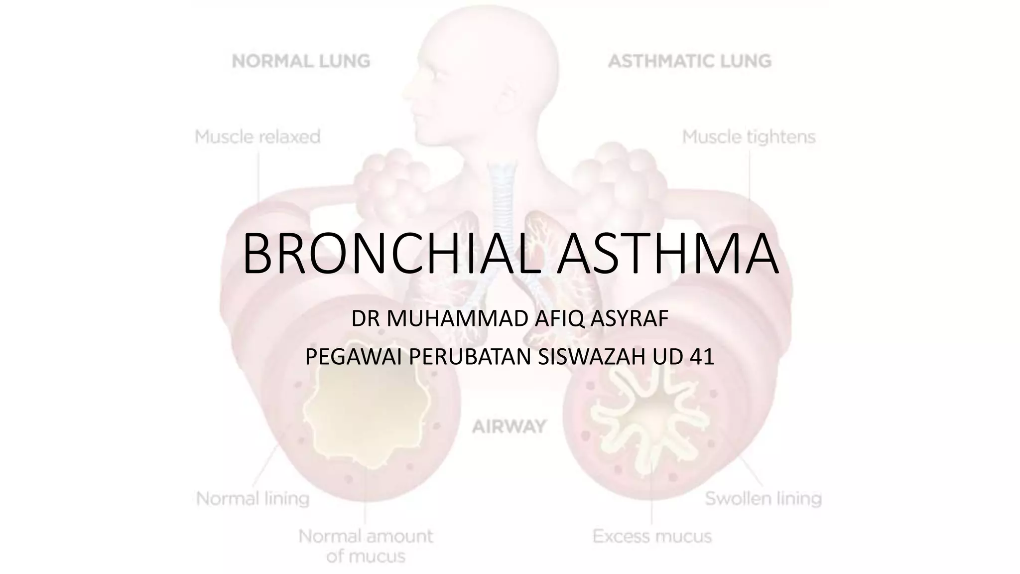 asthma .pptx