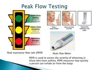 Asthma | PPTX