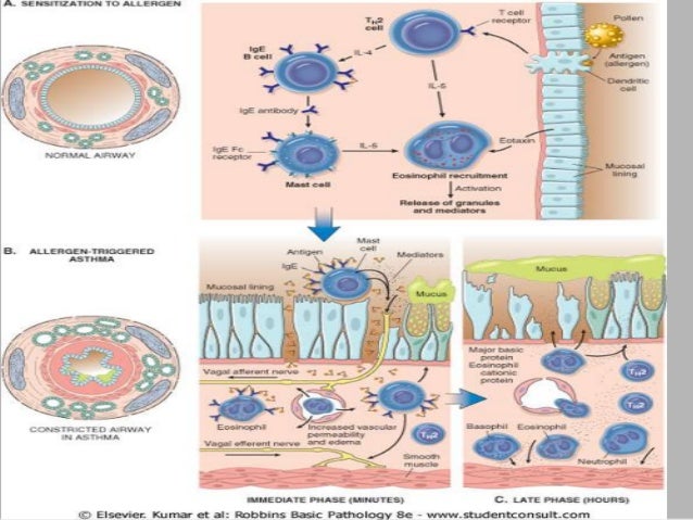 Asthma pathogenesis