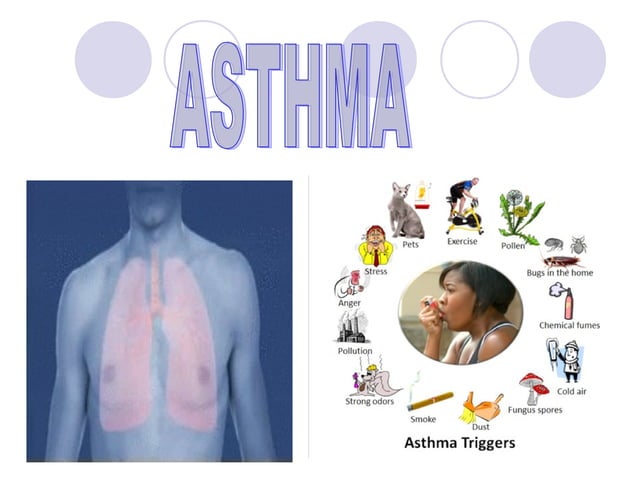 Asthma ppt | PPT | Lung and Respiratory Health | Diseases and Conditions