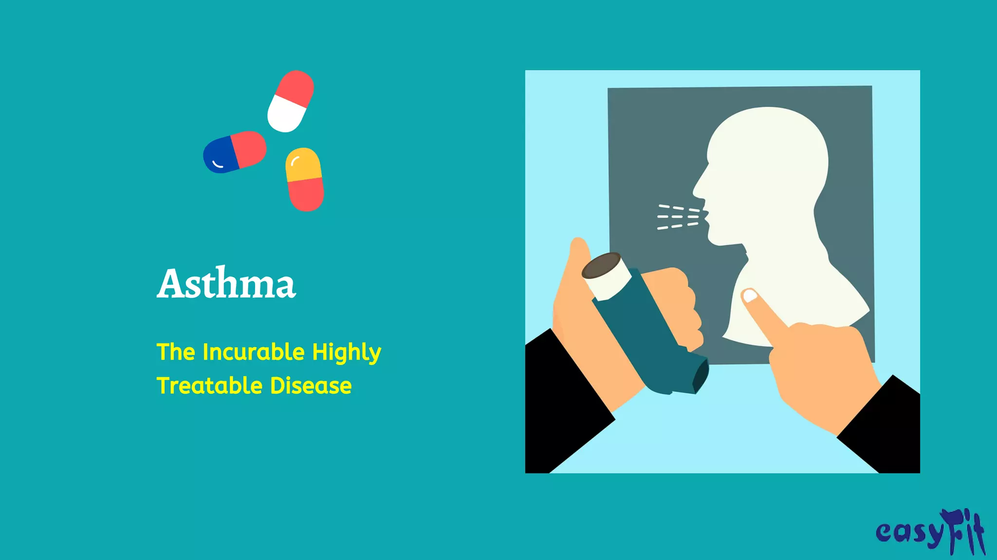 Asthma - The incurable highly treatable disease | PPT