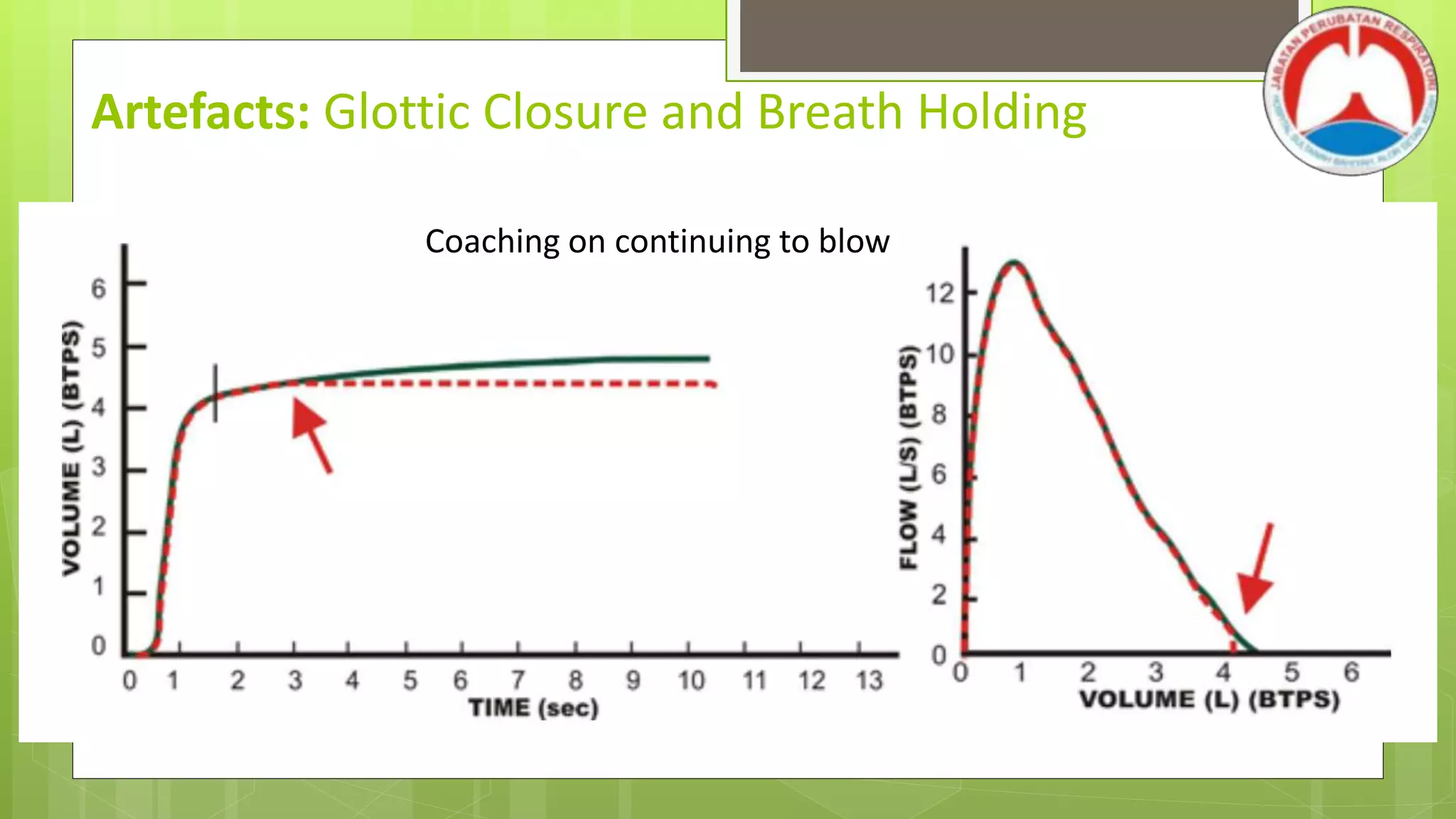 Asthma Update - Spirometry.pptx