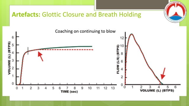 Asthma Update - Spirometry.pptx