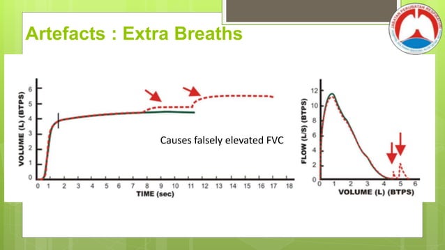 Asthma Update - Spirometry.pptx