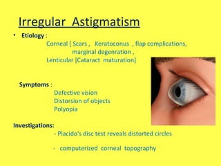 Astigmatism | PPT