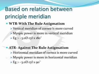 Astigmatism | PPTX