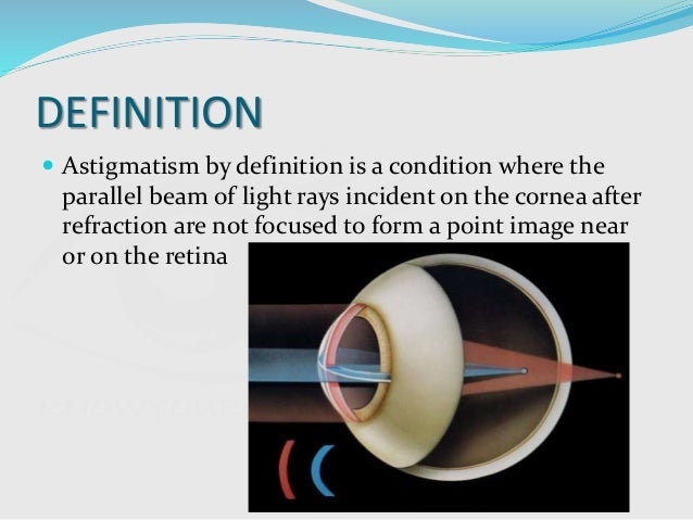Astigmatism Vision Simulator
