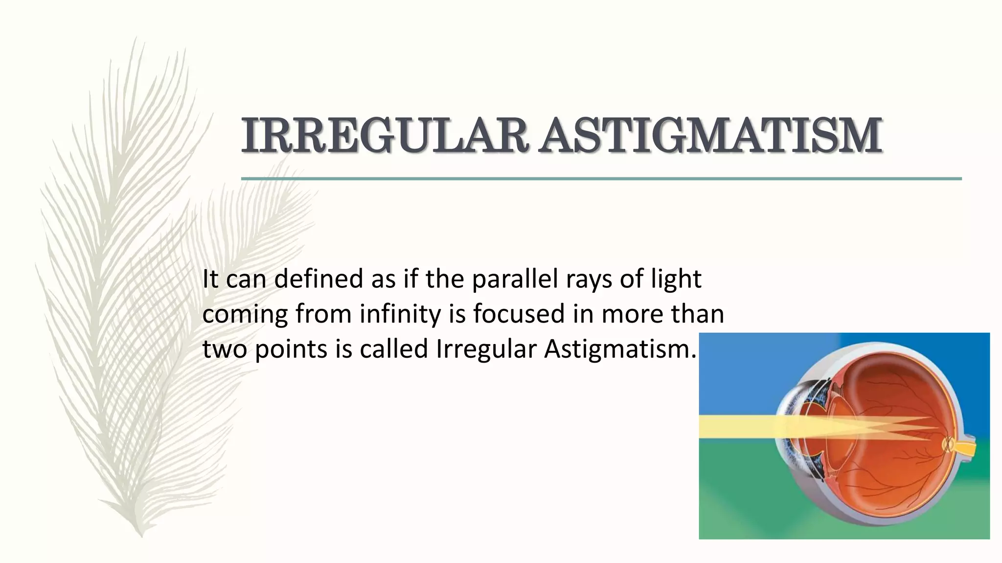 Astigmatism | PPTX