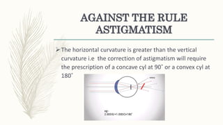 Astigmatism | PPTX
