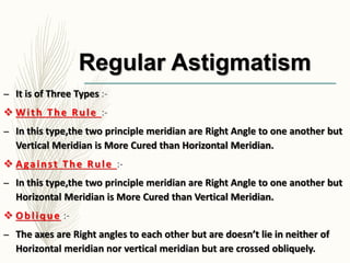 Astigmatism | PPTX