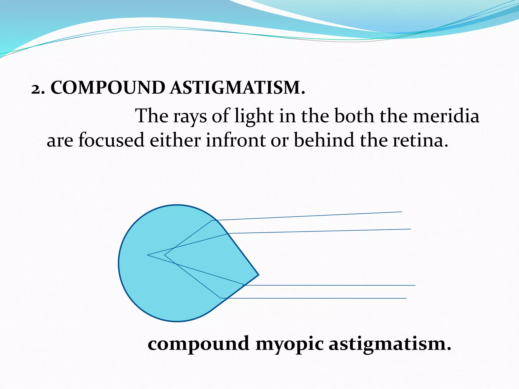 Astigmatism | PPTX | Eye and Vision Conditions | Diseases and Conditions