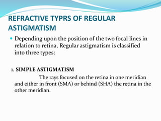 Astigmatism | PPTX | Eye and Vision Conditions | Diseases and Conditions