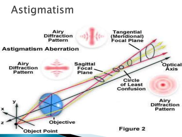 Astigmatism | PPT | Free Download