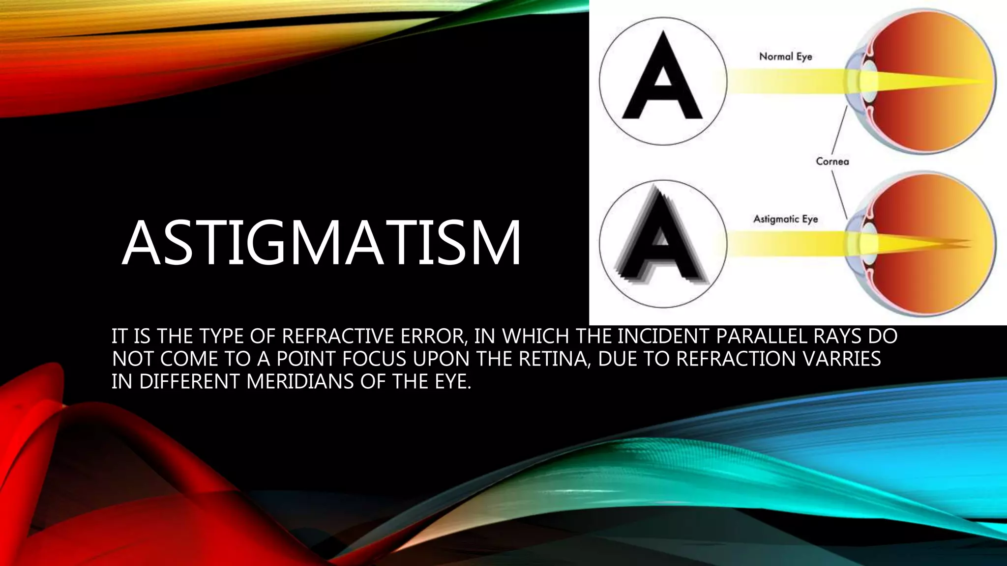Astigmatism | PPTX