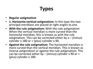 Astigmatism | PPTX