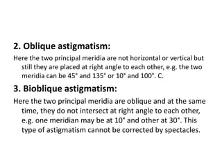 Astigmatism | PPTX