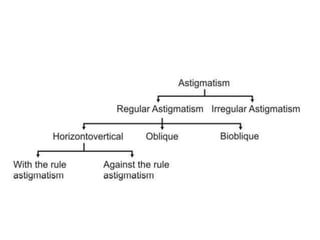 Astigmatism | PPTX