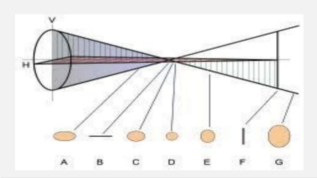 Astigmatism | PPT