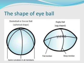 Sturm's Conoid | PPTX
