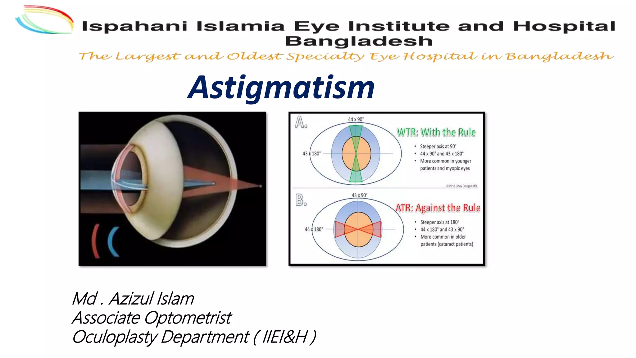 Astigmatism ppt | PPTX