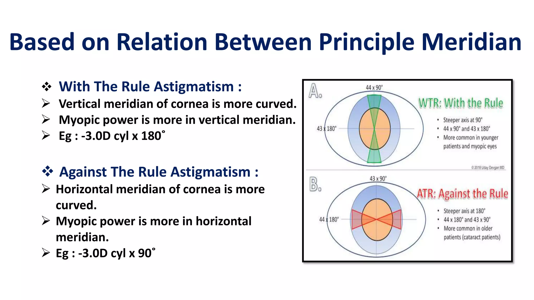 Astigmatism ppt | PPTX