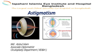 Astigmatism ppt | PPTX