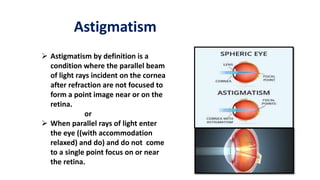 Astigmatism ppt | PPTX