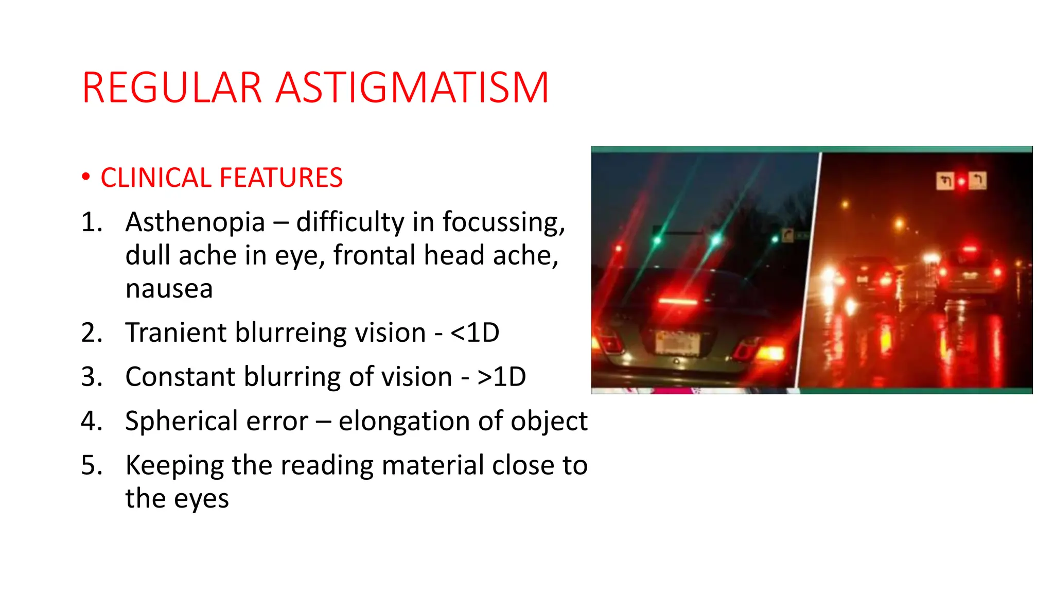 Astigmatism, Classification, Sturm's conoid | PPTX